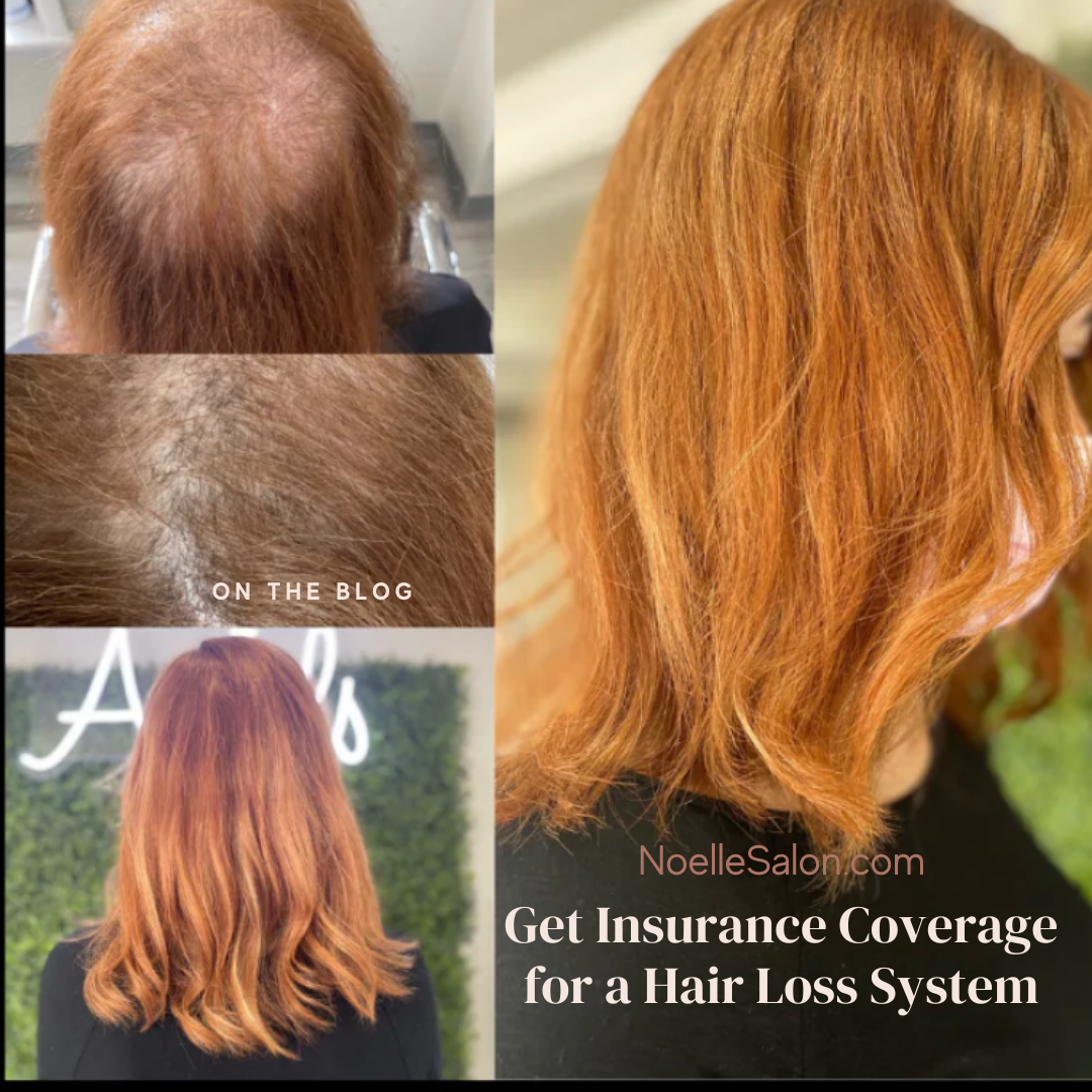 Hair Topper & Hair Loss Insurance: Essential Coverage Guide – noellesalon