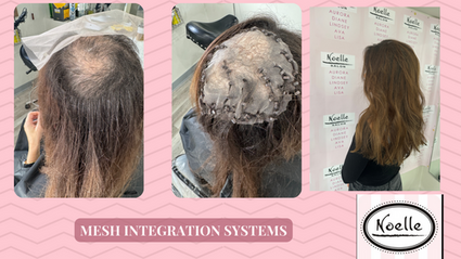 Mesh Integration Hair System: The Ultimate Game Changer | Noelle Salon